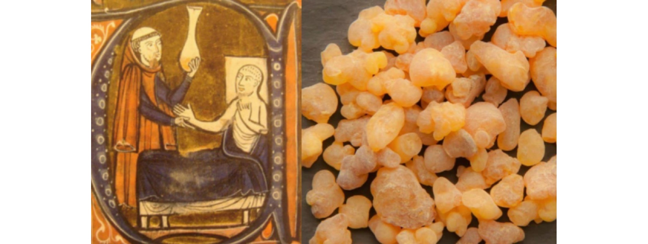 Tamaia sau Boswellia Serrata - Remediul Natural Antidurere